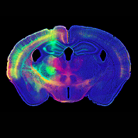Latest Brain Reconstruction and Mapping topics - MBF Bioscience