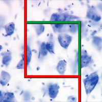 Latest Stereology topics - MBF Bioscience
